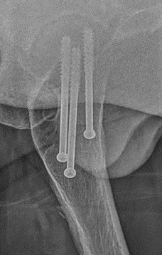 Fixation | The Bone School